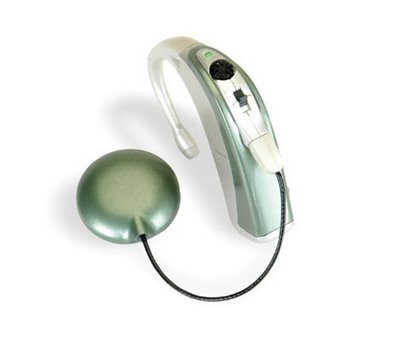 Koklear İmplant Eğitimi - İlkemiz Özel Eğitim ve Rehabilitasyon Merkezi